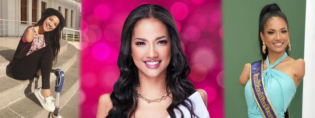Victoria Salcedo นางงามพิการแขนและขา ผู้เข้าประกวด Miss Ecuador 2021